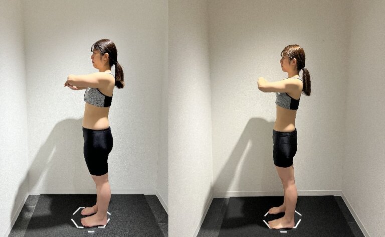 【医療痩身ベストメイクコース】57.7→46.8kg（152cm・30代女性）| 医療ダイエットモニターNo.001 | 【ディオクリニック公式】医療ダイエット・痩身・脂肪冷却